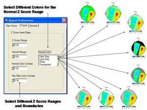 NeuroGuide™ – BrainBit